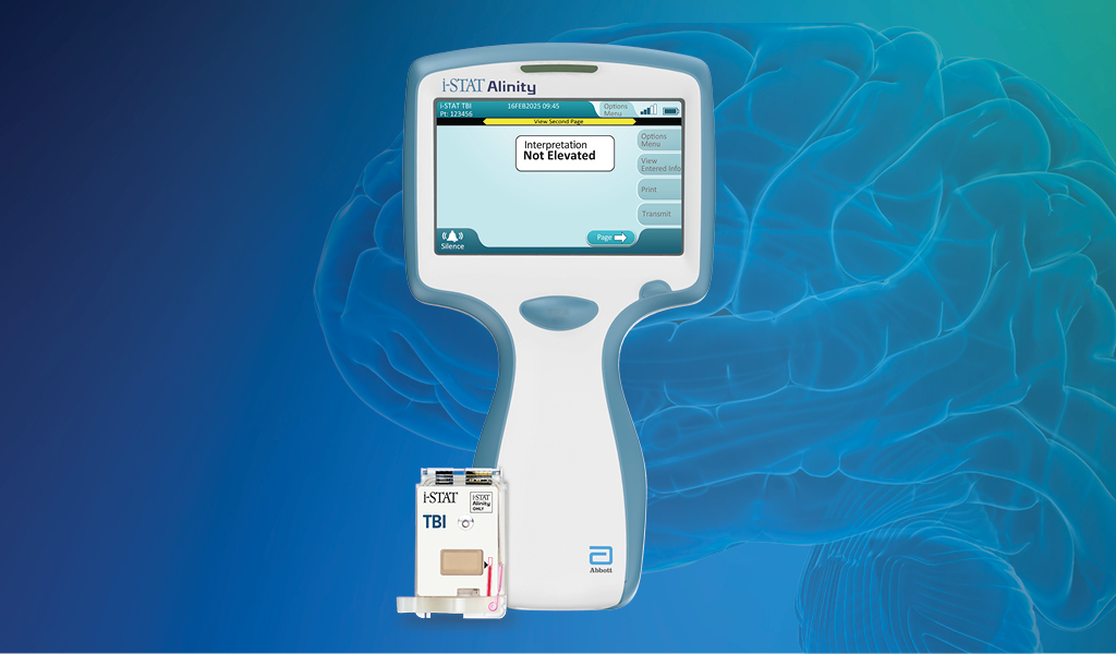 Objective Assessment in Evaluating Suspected mTBI | Diagnostic rapide en POC – Abbott
